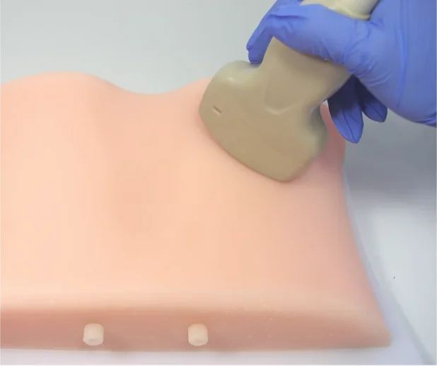 Medical Science Kidney Puncture Model Guided by Ultrasound for Training ...