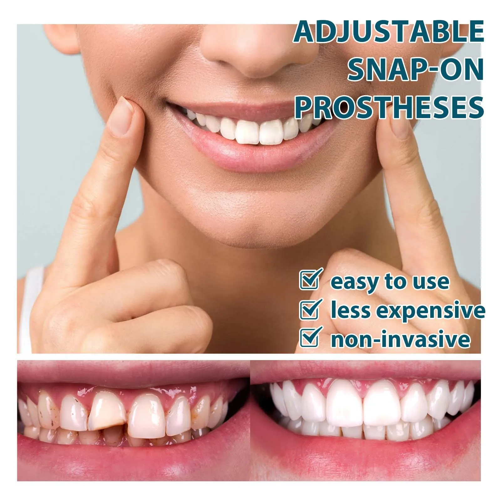Tooth Kit Laugh Veneers - Perfect Smile Cosmetic Dental Tool