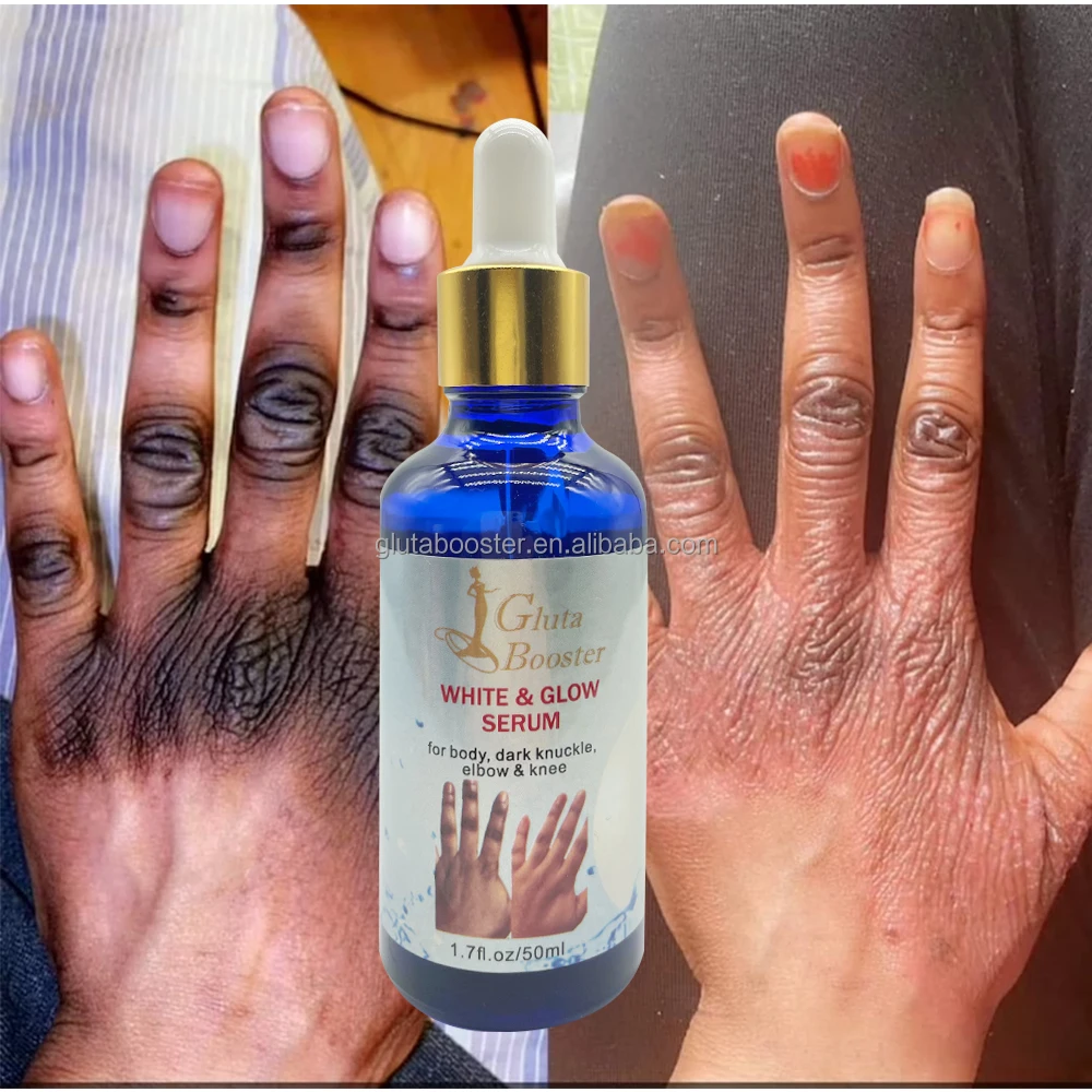 Personalized Private Label Fast Results Clear Knuckles Knees Elbows ...