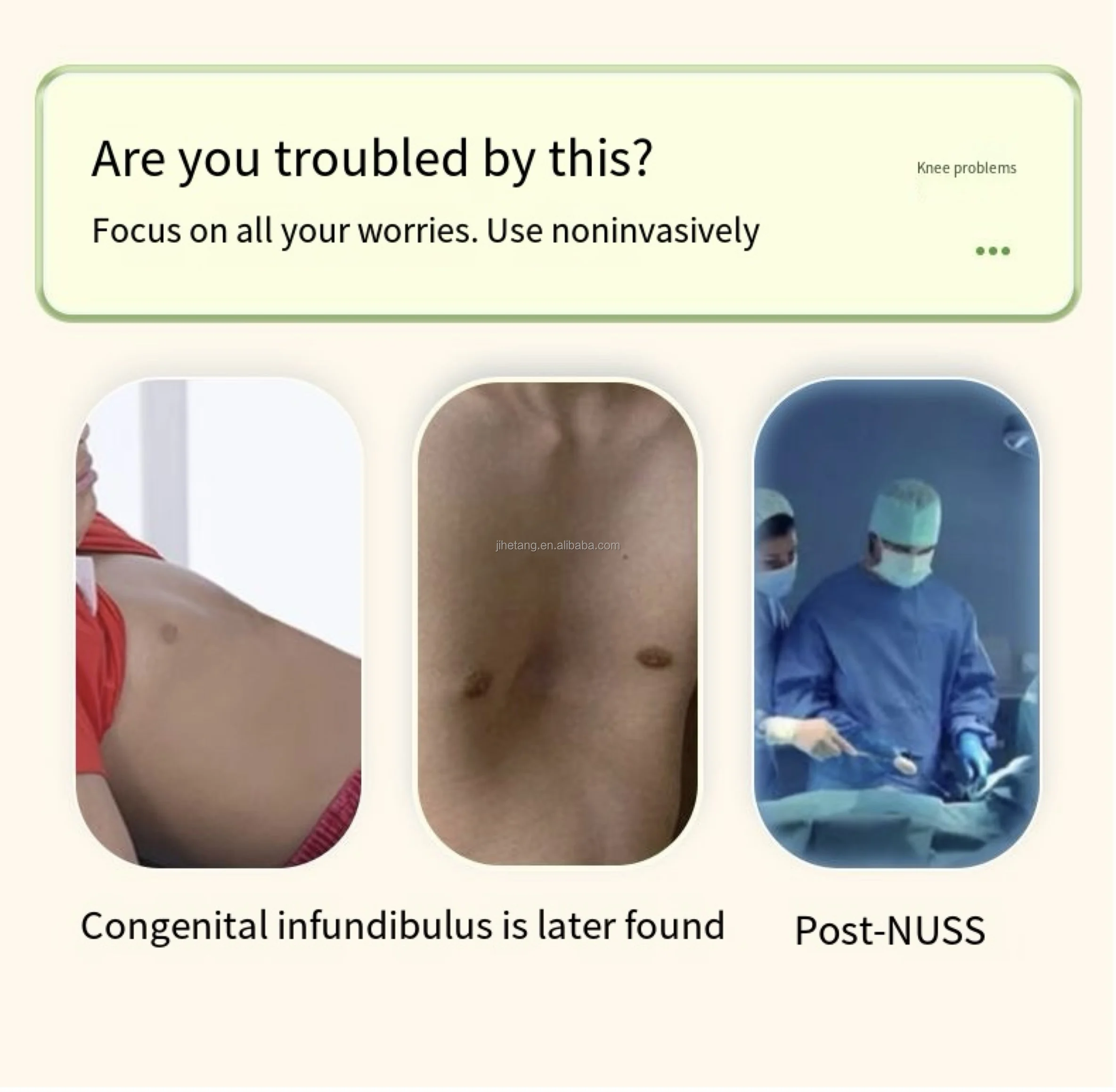 Funnel Chest Negative Pressure Suction Corrector Adult Child Sternum ...