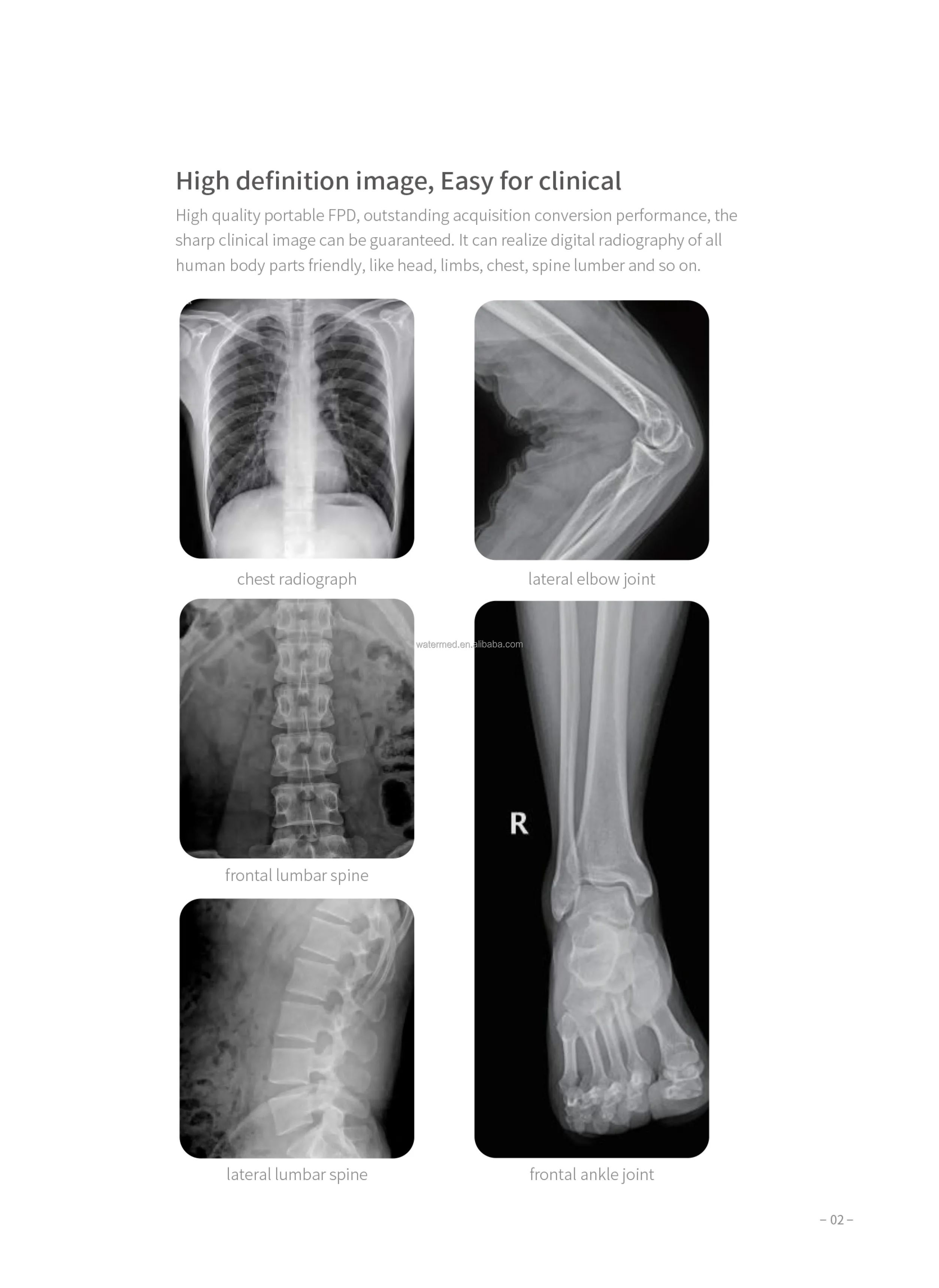 Ce 50kw Digital Dr X-ray Machine Radiography Dr Xray - Buy Iray Wireless Flat Panel Detector ...