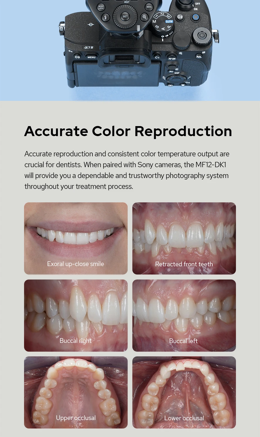 Godox Macro Flash Kit For Mf12-dk1 Macro Mini Flash Speedlite Built-in ...