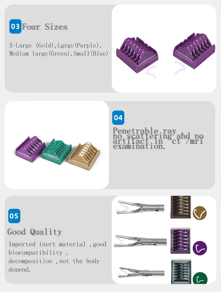 Disposable Polymer Ligation Clips And Titanium Clips Lt300 - Buy ...