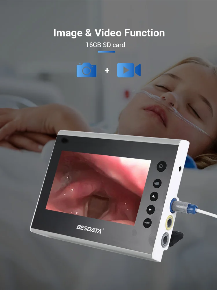 BESDATA Bronchoscopy Ent Endoscope System for Surgical Use