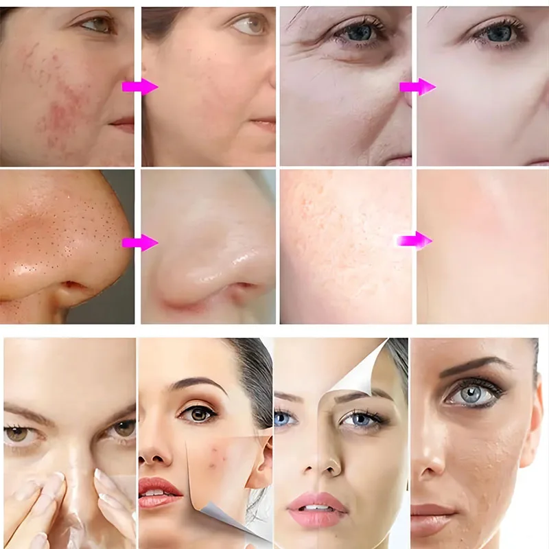 Co2 Bubble 3 in 1 Oxygen Therapy Facial Machine - Skin Rejuvenation