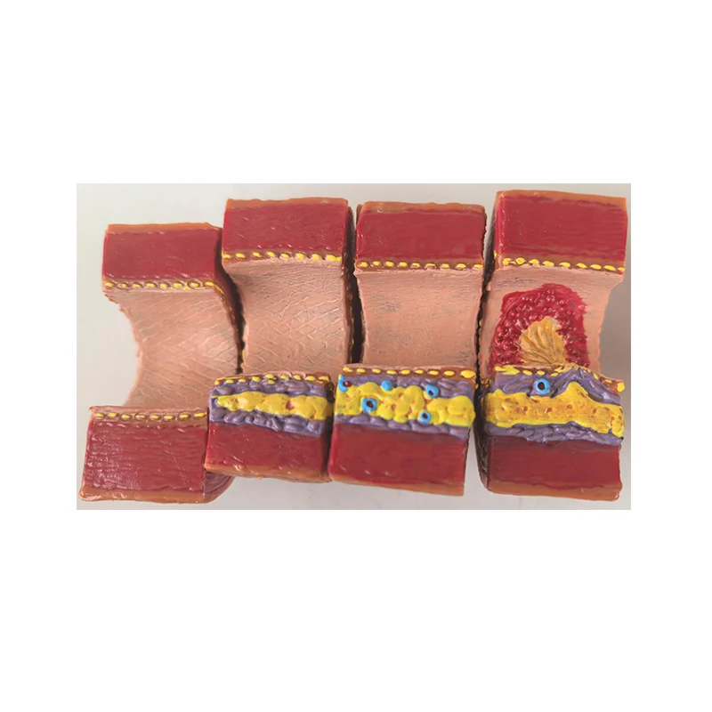 Realistic Artery Atherosclerosis Model 7-Segment | Lab & Medical ...