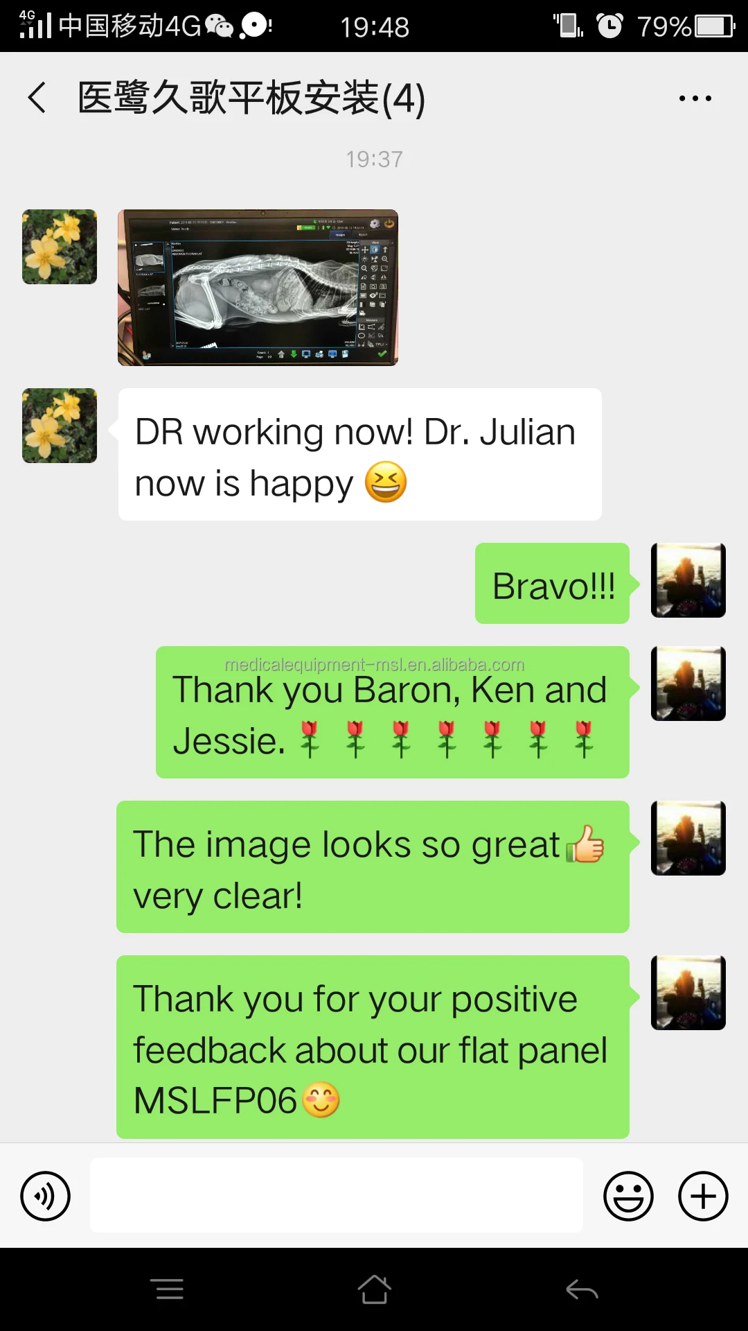 Iray Medical X-Ray Equipments & Accessories - Digital X Ray Machine ...