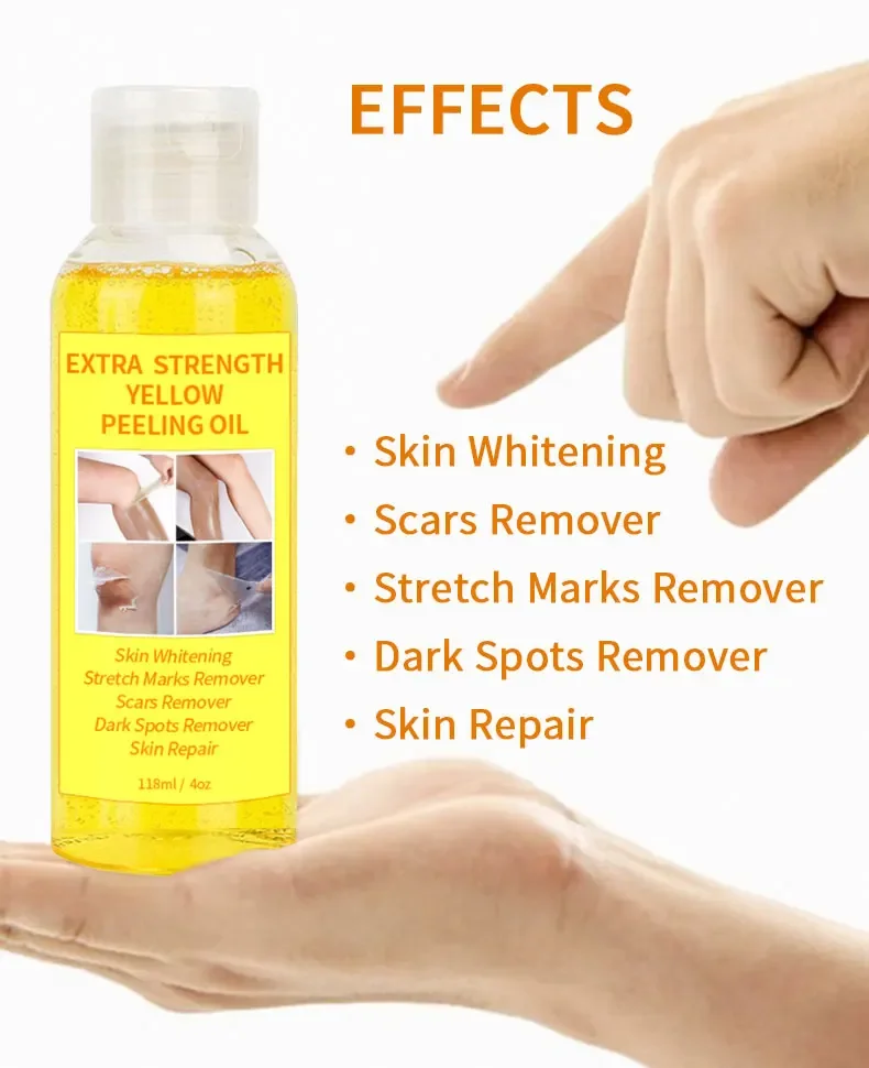 OEM Extra Strength Peeling Oil Yellow Vitamin C & E Knuckle Whitening ...