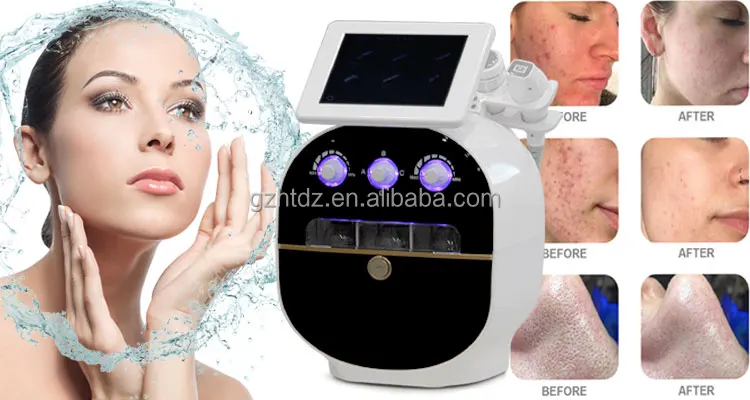 Best Sale Ems Diamond Peel Skin Blackhead Remover Water Dermabrasion ...