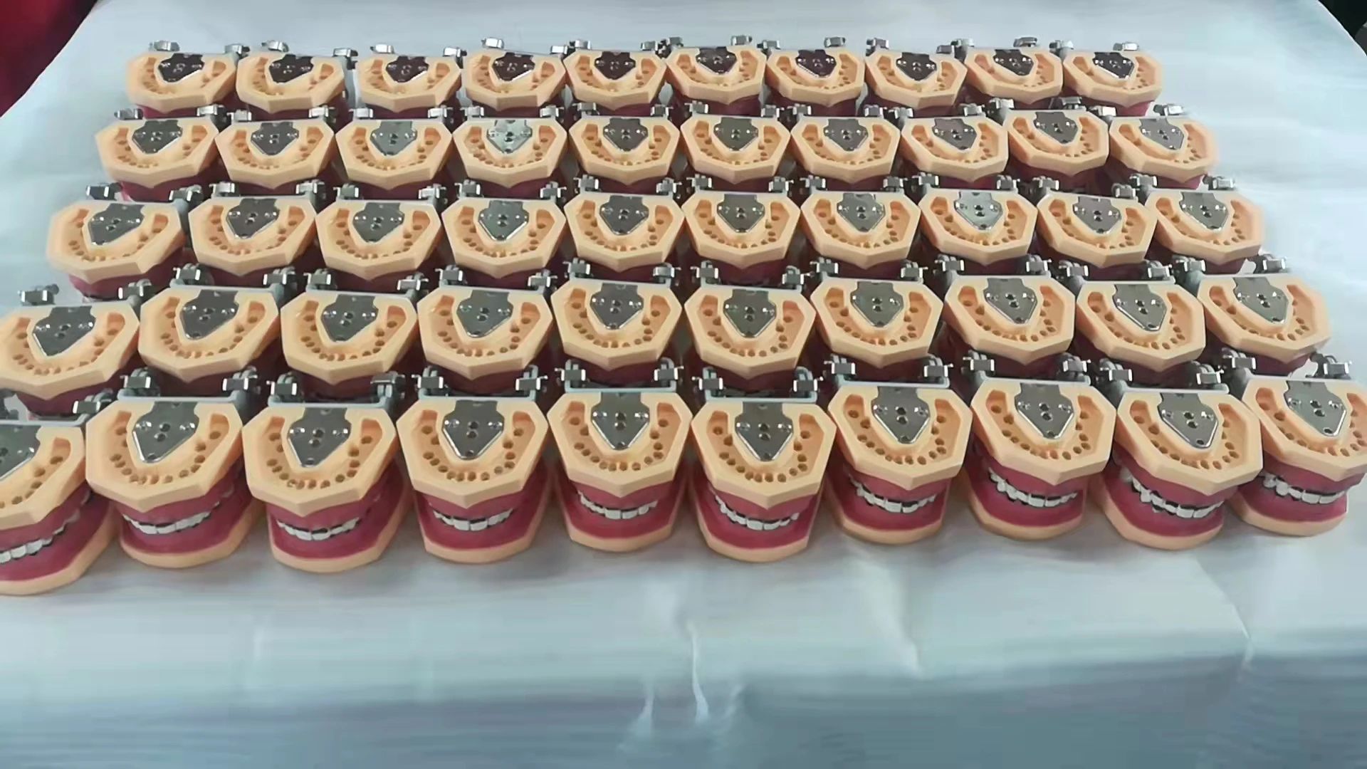 Medical Science Pathological Tooth Model Periodontal Tooth Model Used ...