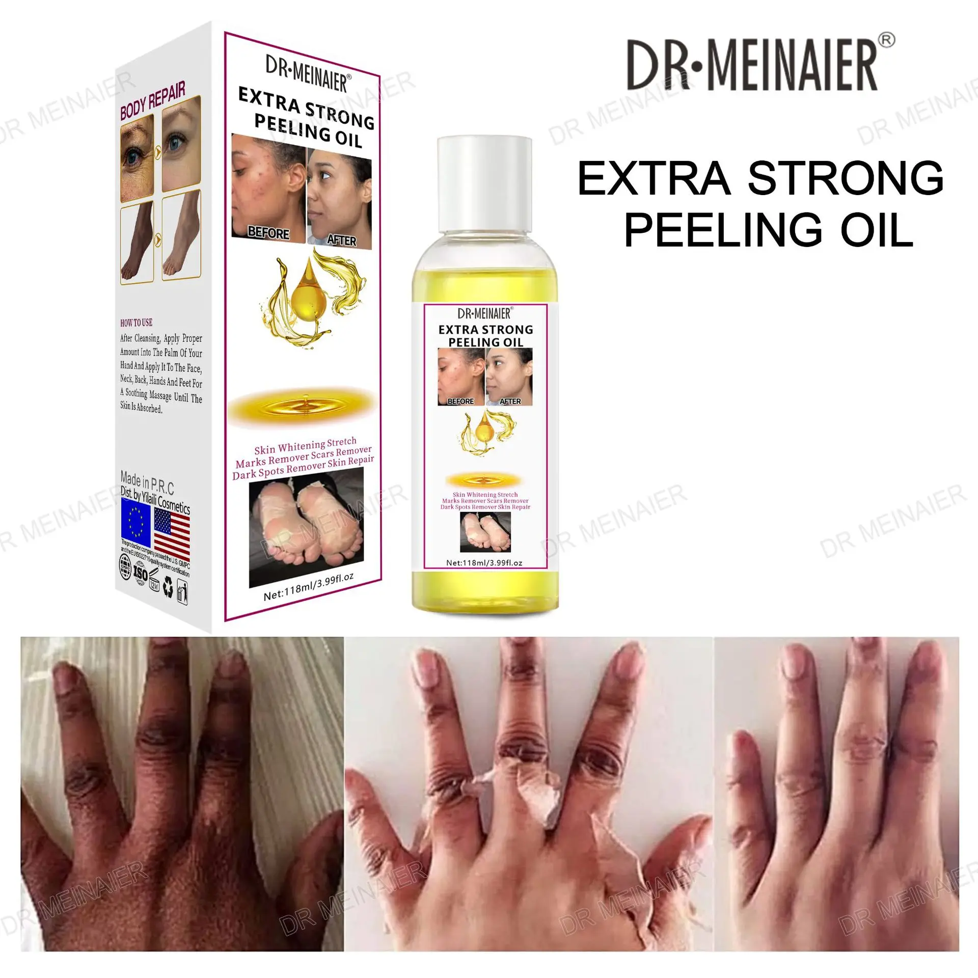 Body Extra Exfoliate Strong Peeling Oil Remove Elbow Knee Fingers Black ...