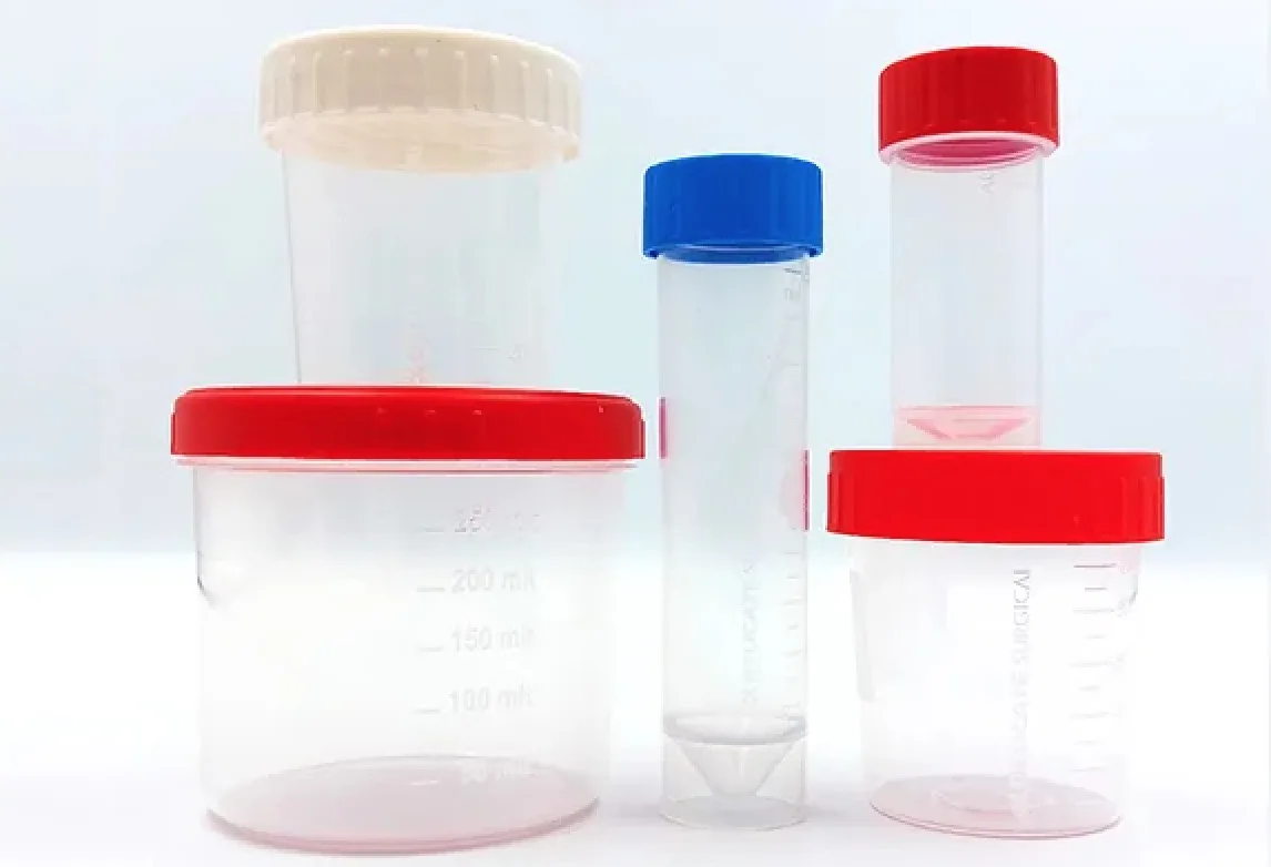 Hospital Disposable Plastic Sterile Specimen Sample Test Stool Urine ...