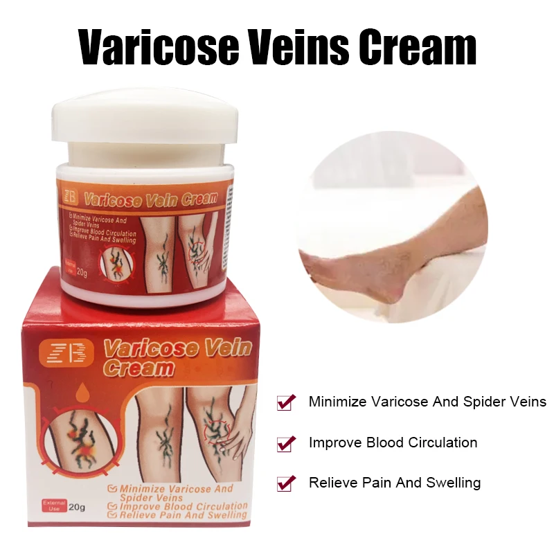 Zb Vascular Rehabilitation Cream Varicose Vein Treatment Cream Spider ...