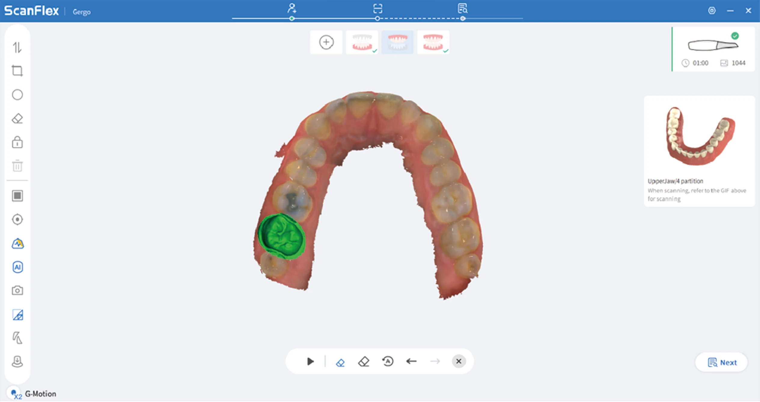 Fussen S6500 Touch Screen Pc Cart Dental Oral Intraoral Scanner