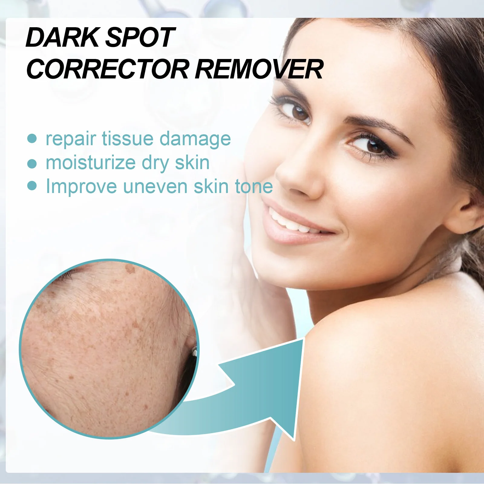 Dark Spot Corrector Cream Melasma Treatment for Face Hyperpigmentation Treatment Freckle Remover ...