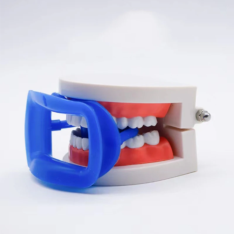 Dentist Teeth Whitening Retractor Mouth Opener Cheek Retractors Dental ...