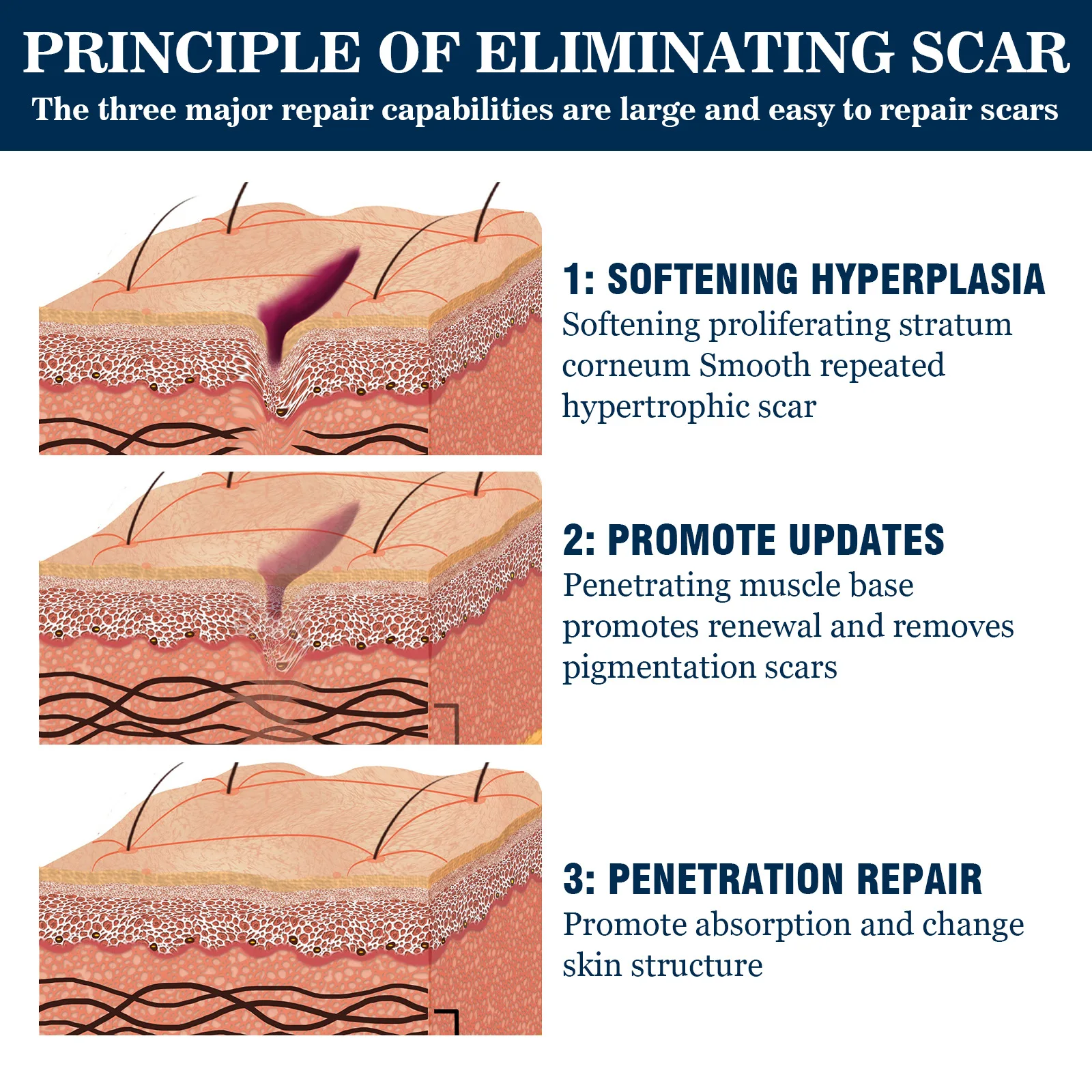 West&month Fade Body Scar Repair - Natural Scar Gel Cream