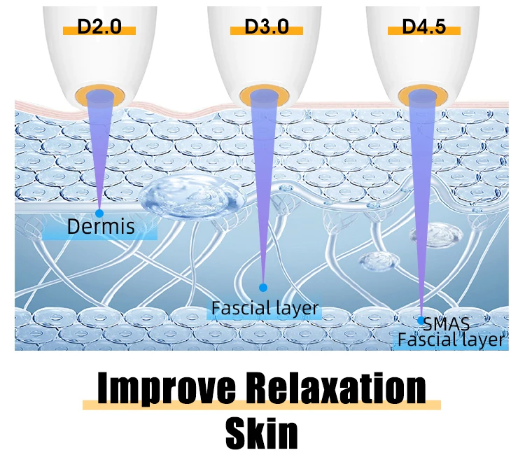 7D Hifu Machine for Face Lifting - Winkle Removal & Tightening