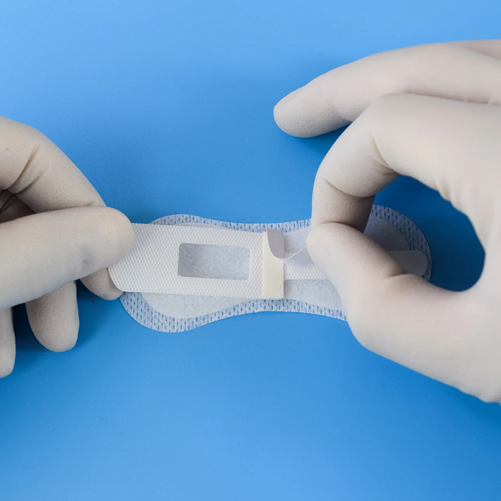 Catheter Fixation Device - Secure and Comfortable Solutions
