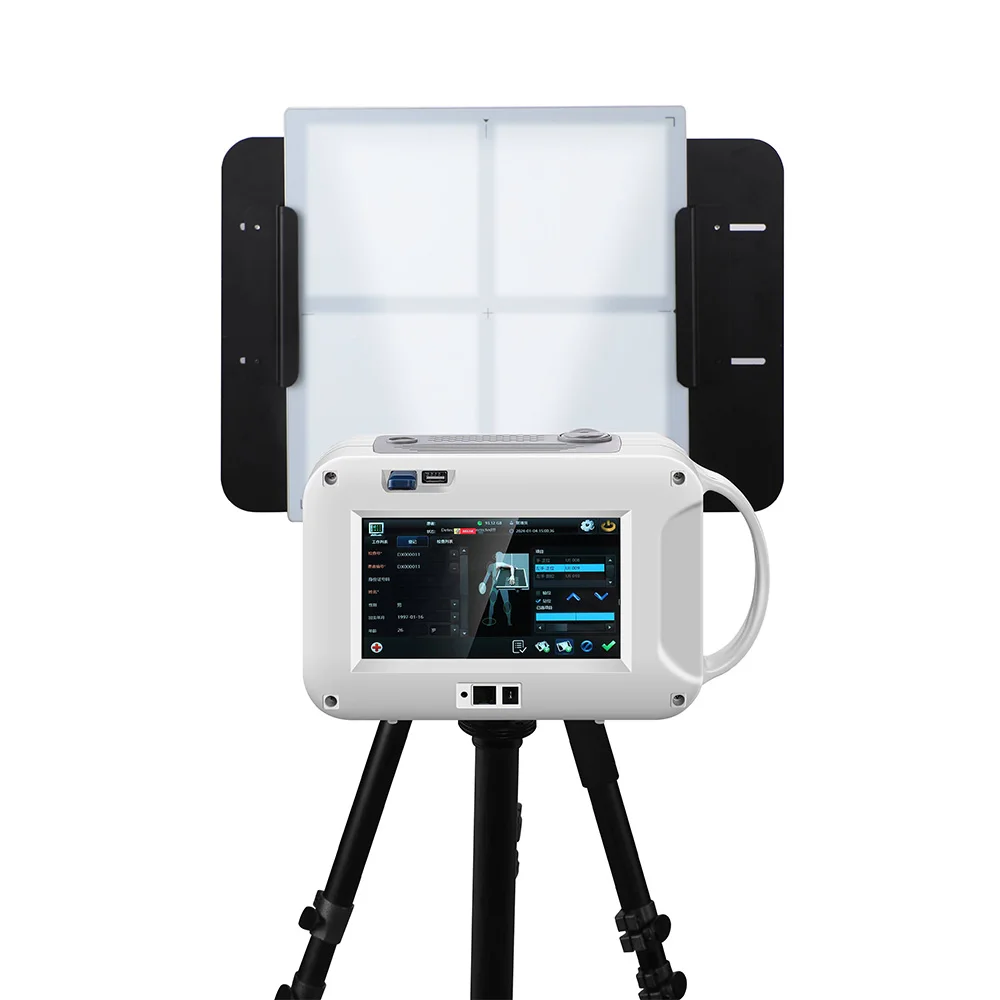 Portable Veterinary X Ray Machine Portable Camera DR Scan Machine ...