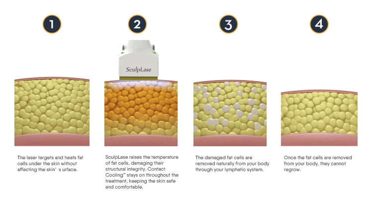 Best Selling Intelligent Operation Laser Weight Loss 1064nm Diode ...