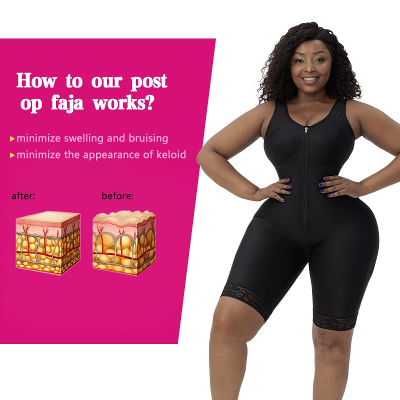 High Compression Post Op One-piece Zipper Faja Tummy Control Slimming ...