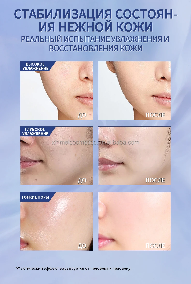 Russia Hydration Moisturization Anti-Wrinkle Skin Care Set