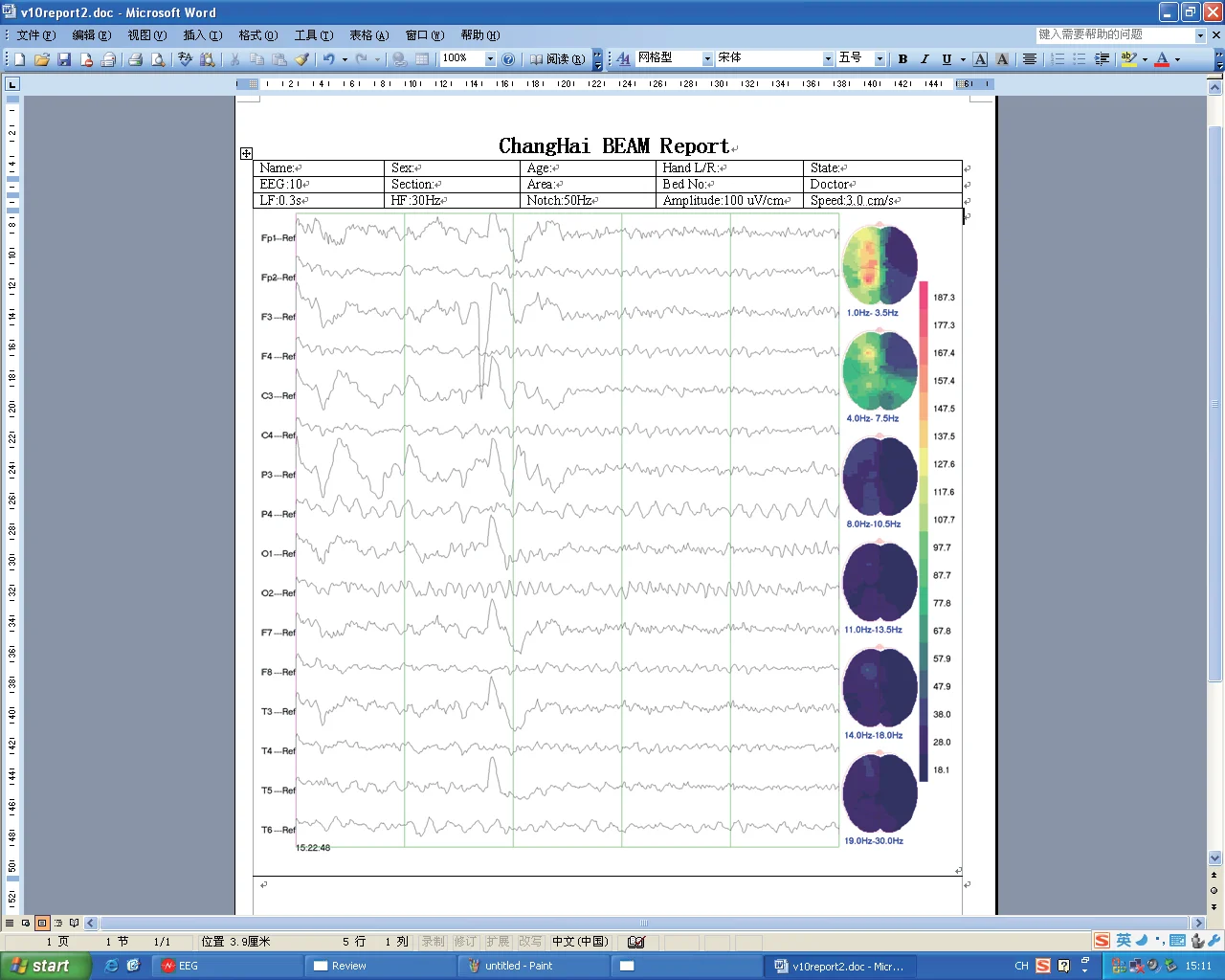 Dry Eeg Emg Electrodes Electrocap For Eeg Machine Device Equipment 24 ...