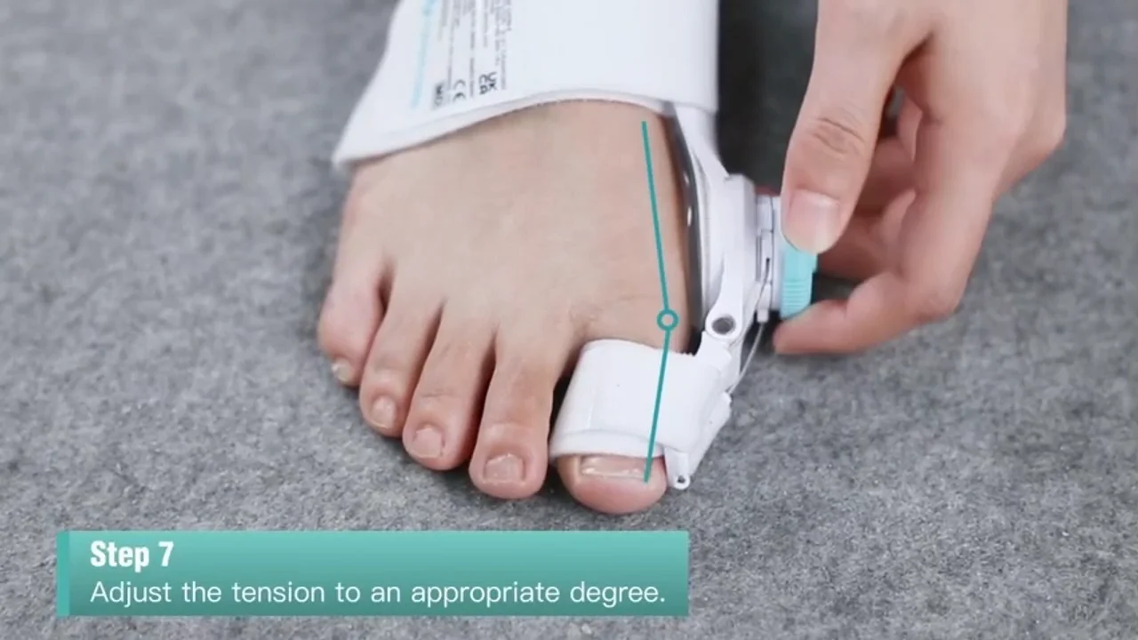 Tenicore Adjustable Bunion Corrector Big Bone Toe Bunion Brace Splint ...