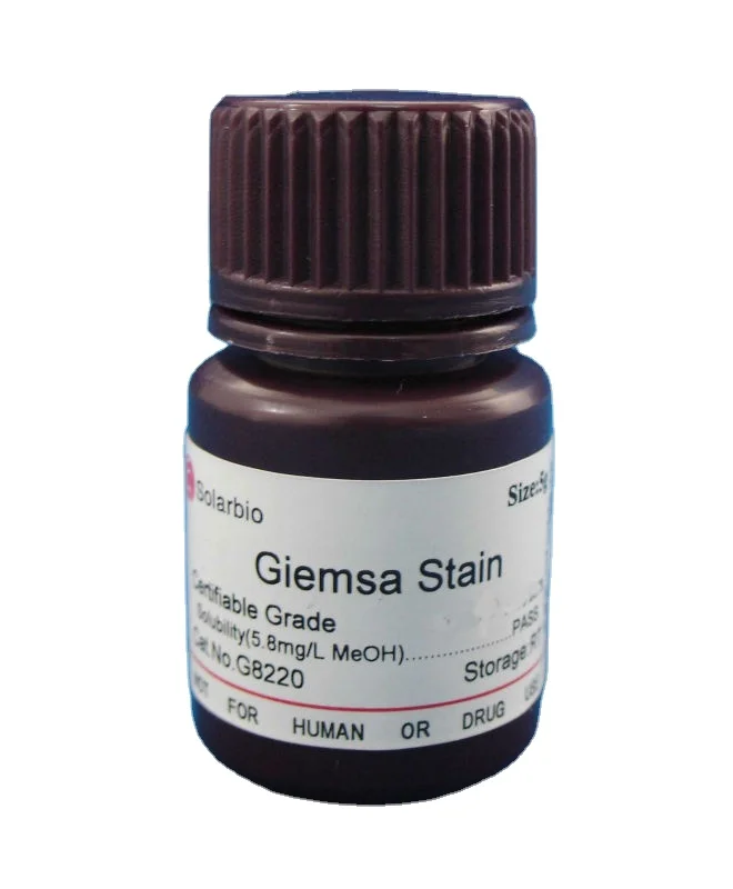 Solarbio Reticulin stain Kit, Modified Gordon-Sweets For Scientific Research| Alibaba.com