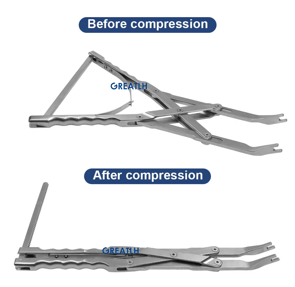 Orthopedic Surgical Instrument Orthopedic Parallel Compression Pliers ...