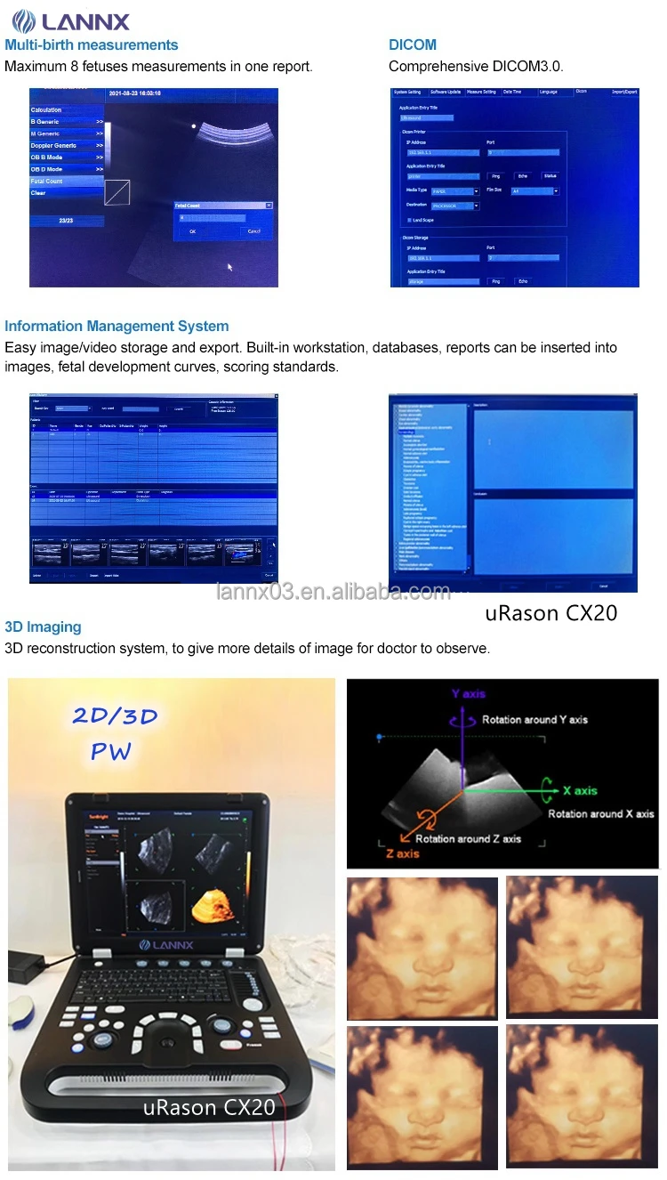Lannx Urason Cx20 Hd Screen Laptop Digital Cardiology Ultrasound Medical 2d/3d Optional ...