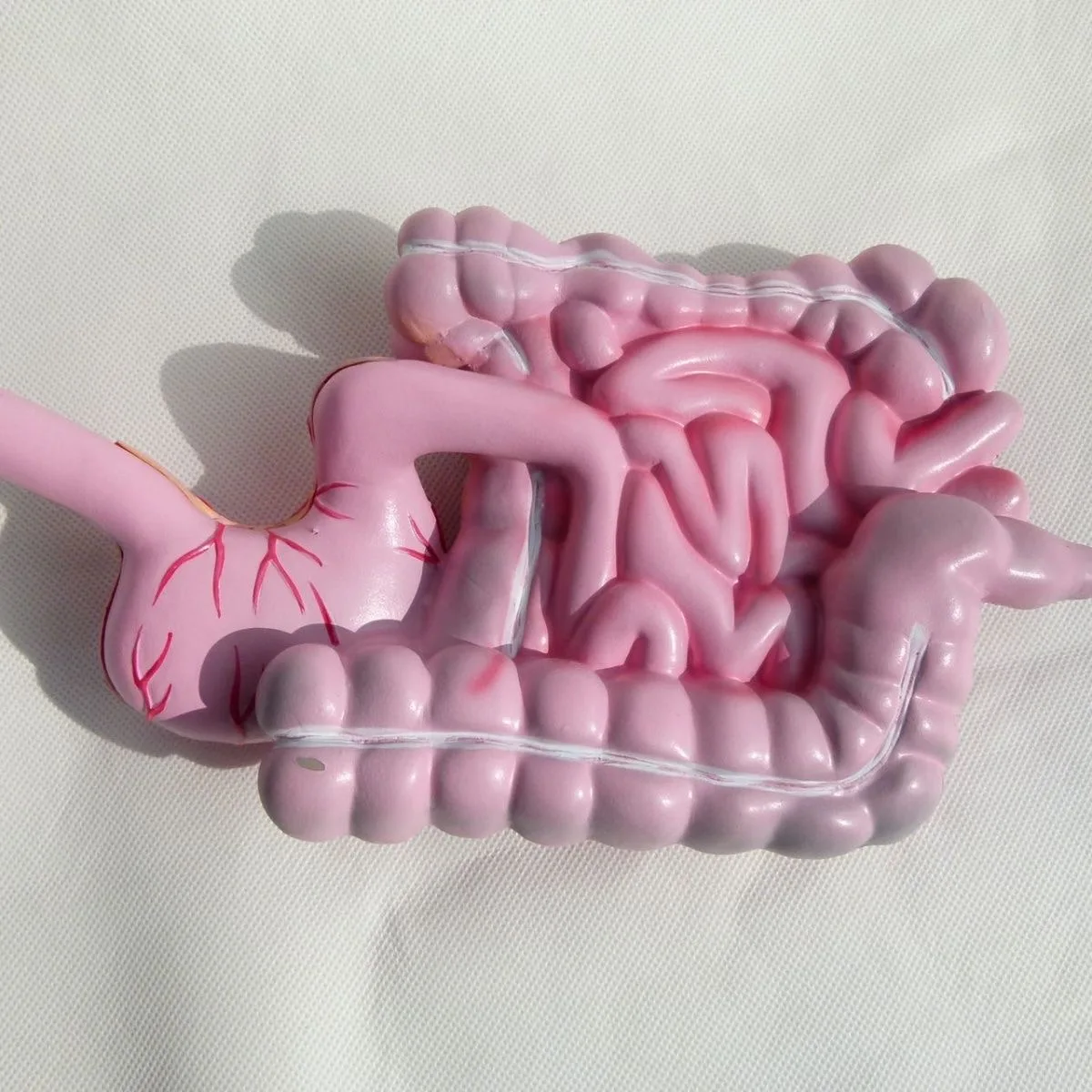 KyrenMed Pathological Human Digestive System Anatomical Model Colon ...