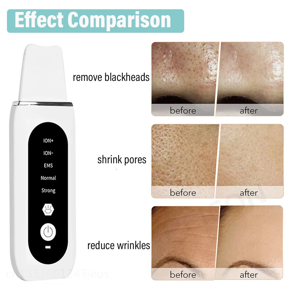 Microdermabrasion Machine Professional Facial Vacuum Pore Cleaner ...