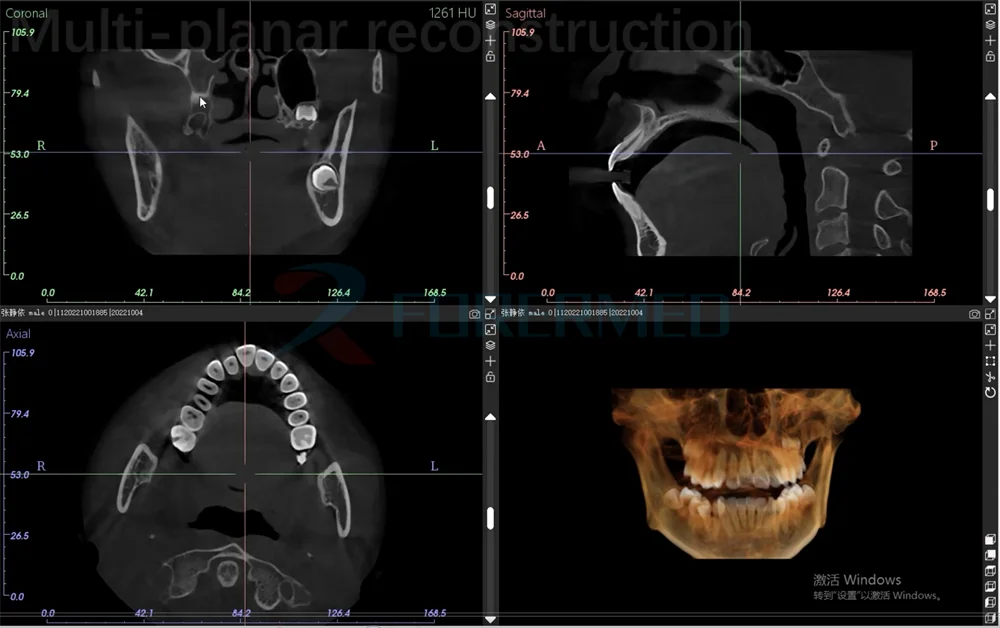 4 In 1 Digital Cbct Dental X Ray M2 Fov Cone Beam Ai Computed ...