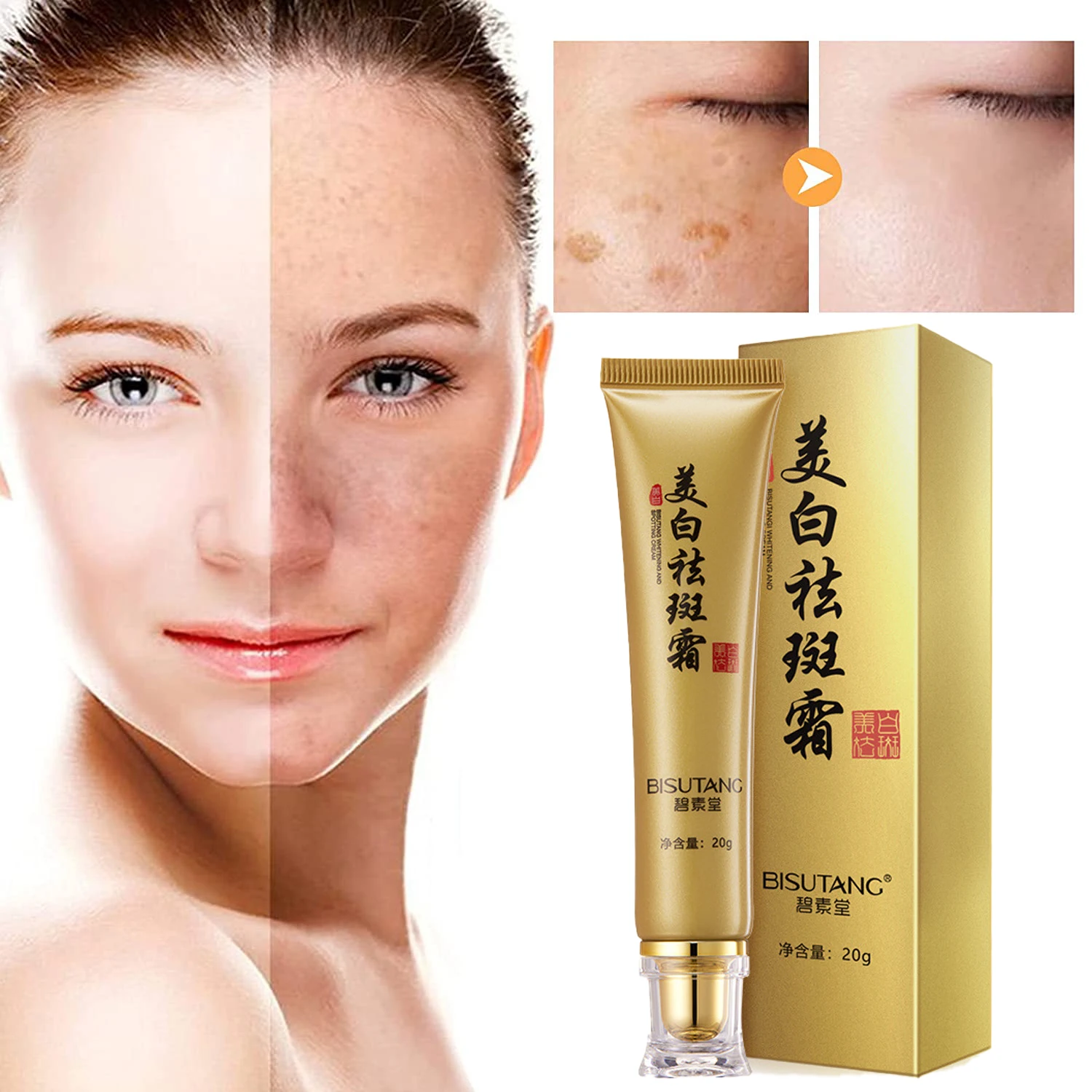 Bisutang Whitening Freckles Cream Remove Melasma Dark Spot Lightening ...