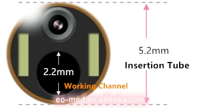 Handheld Flexible Video Intubation Laryngoscope for Difficult Intubation