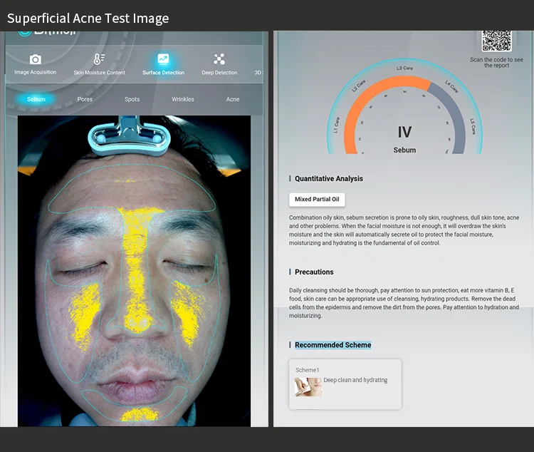 Face Scanner Skin Analyzer Skin Analyzer Professional Skin Analyzer ...