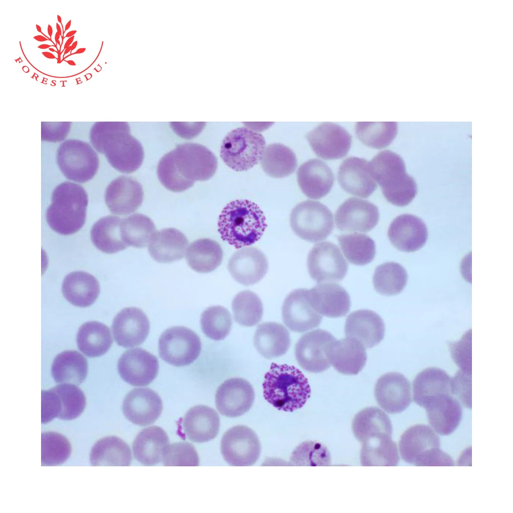 Plasmodium Vivax Blood Smears - Microscopy for Medical Research