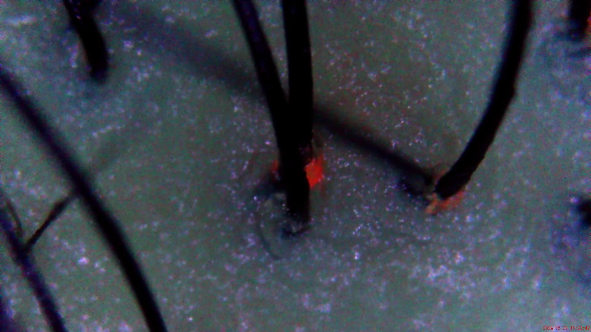 UV Light Scalp Machine Hair Scalp Diagnosis with Replaceable Nozzles ...