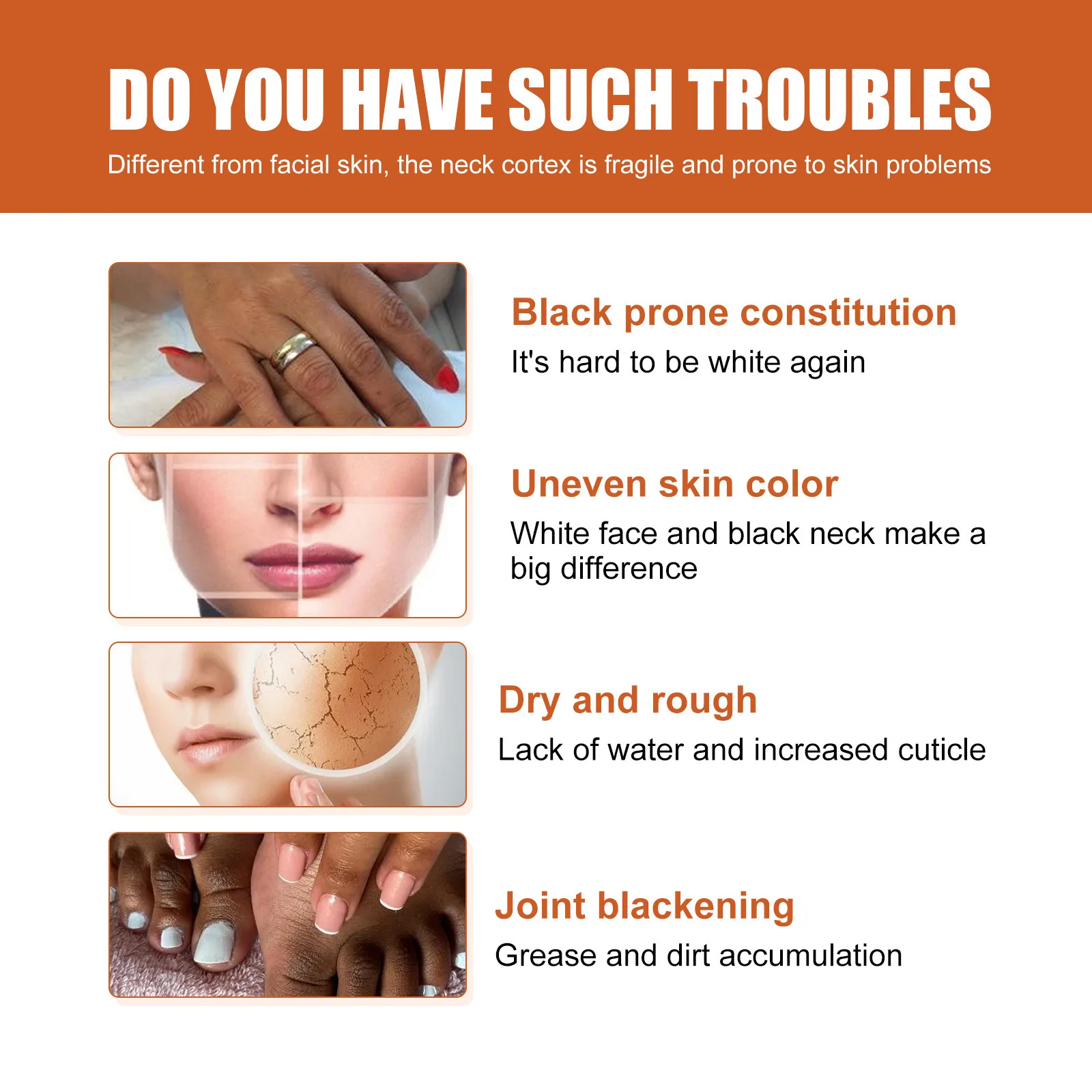 Dark Knuckles Fast Whitening Serum – Pigmentation Corrector for Hands ...
