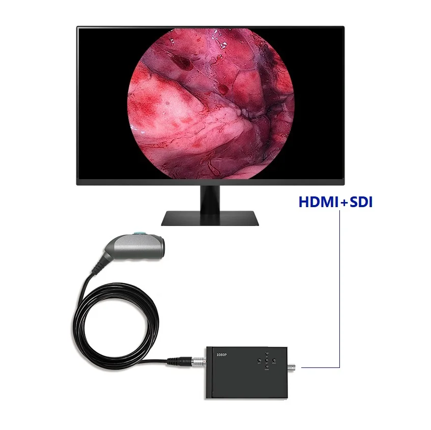 HDMI SDI Mini Medical ENT Endoscopy Camera for Clinic VET