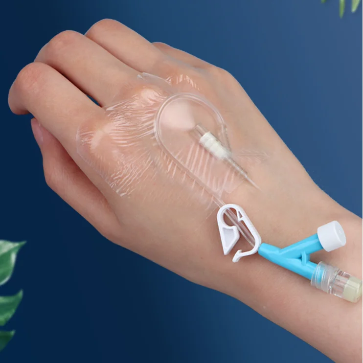 Transparent Semi-permeable Window Frame Dressing Iv Dressing - Buy ...