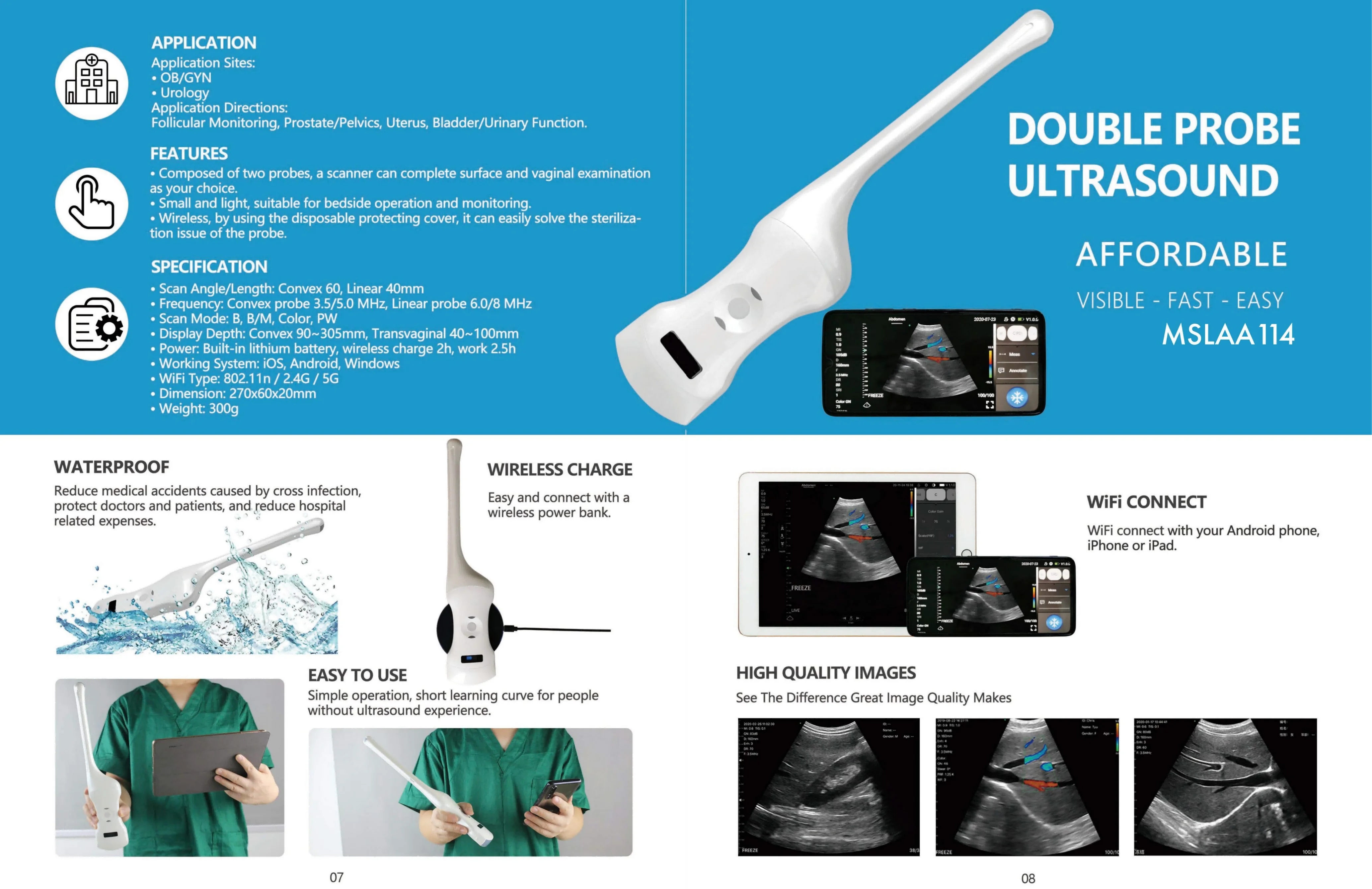 Highest Cost-effective Double Probes Wireless Color Doppler Ultrasound ...