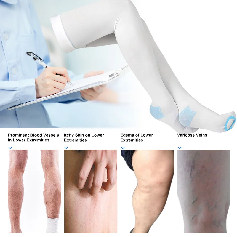 Custom Anti-Embolism Socks - Thigh High Compression Stockings