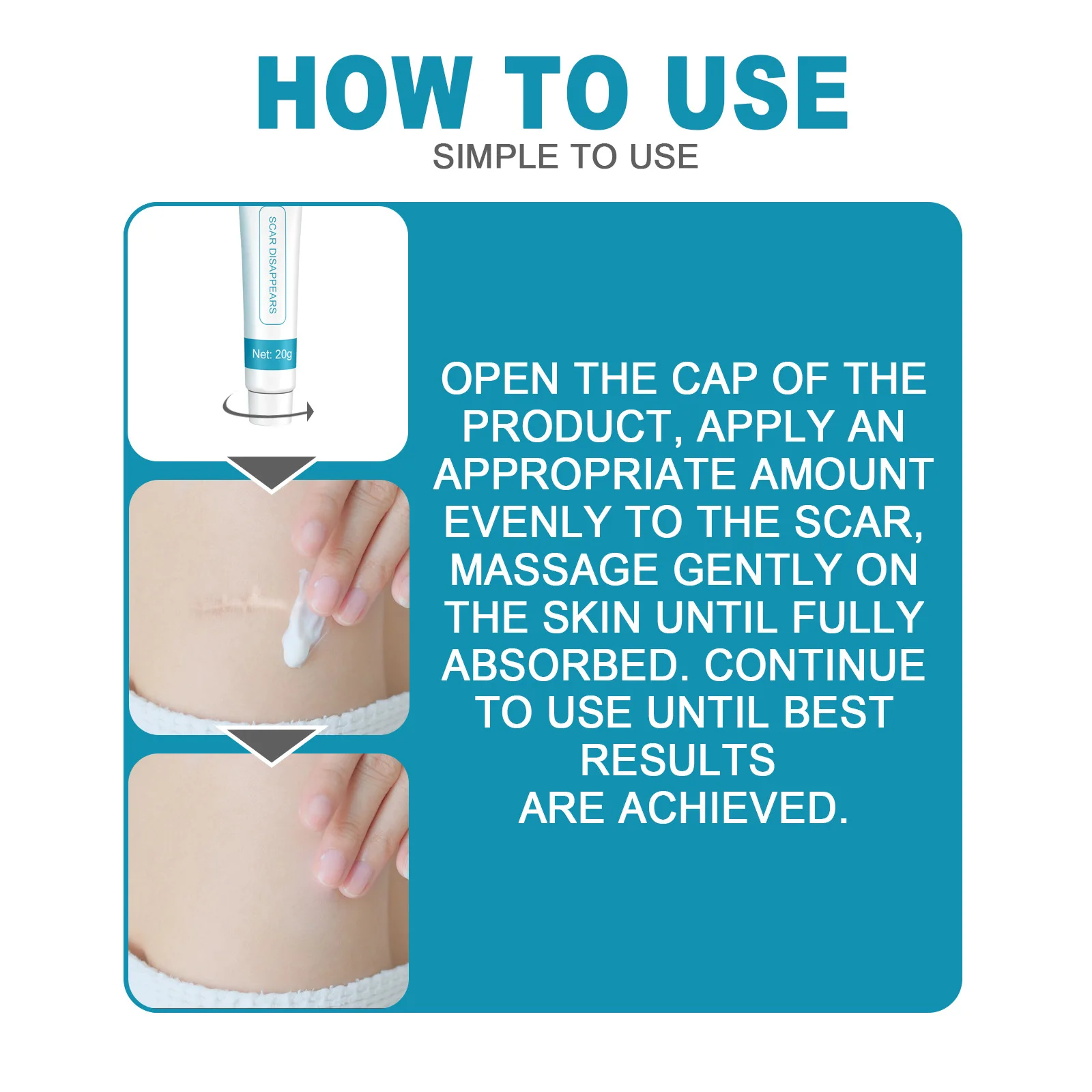 Private Label Acne Scar Removal Cream Effective Fade Old Scars ...