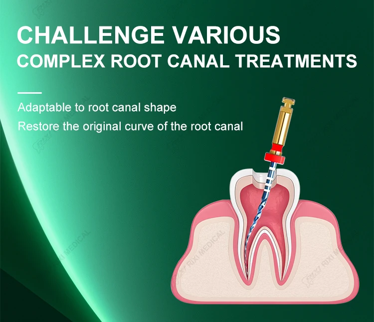 MRF Blue Rotary Files - Advanced Dental Endo Solutions