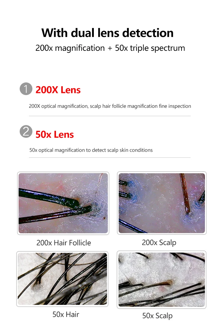 Skin Hair Analyzer Microscopes Hair Follicle Analyzer Skin Analysis ...