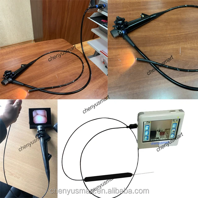 Custom Solution for Medical Endoscope Camera Module