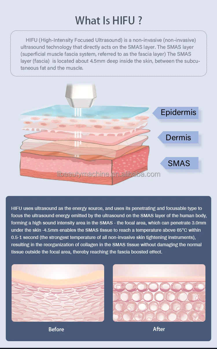 Mini Device Make Collagen & Elastic Fibers Recover & Regenerate Home ...